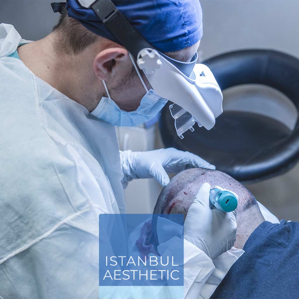 DHI Hair Transplantation – Istanbul Aesthetic Center